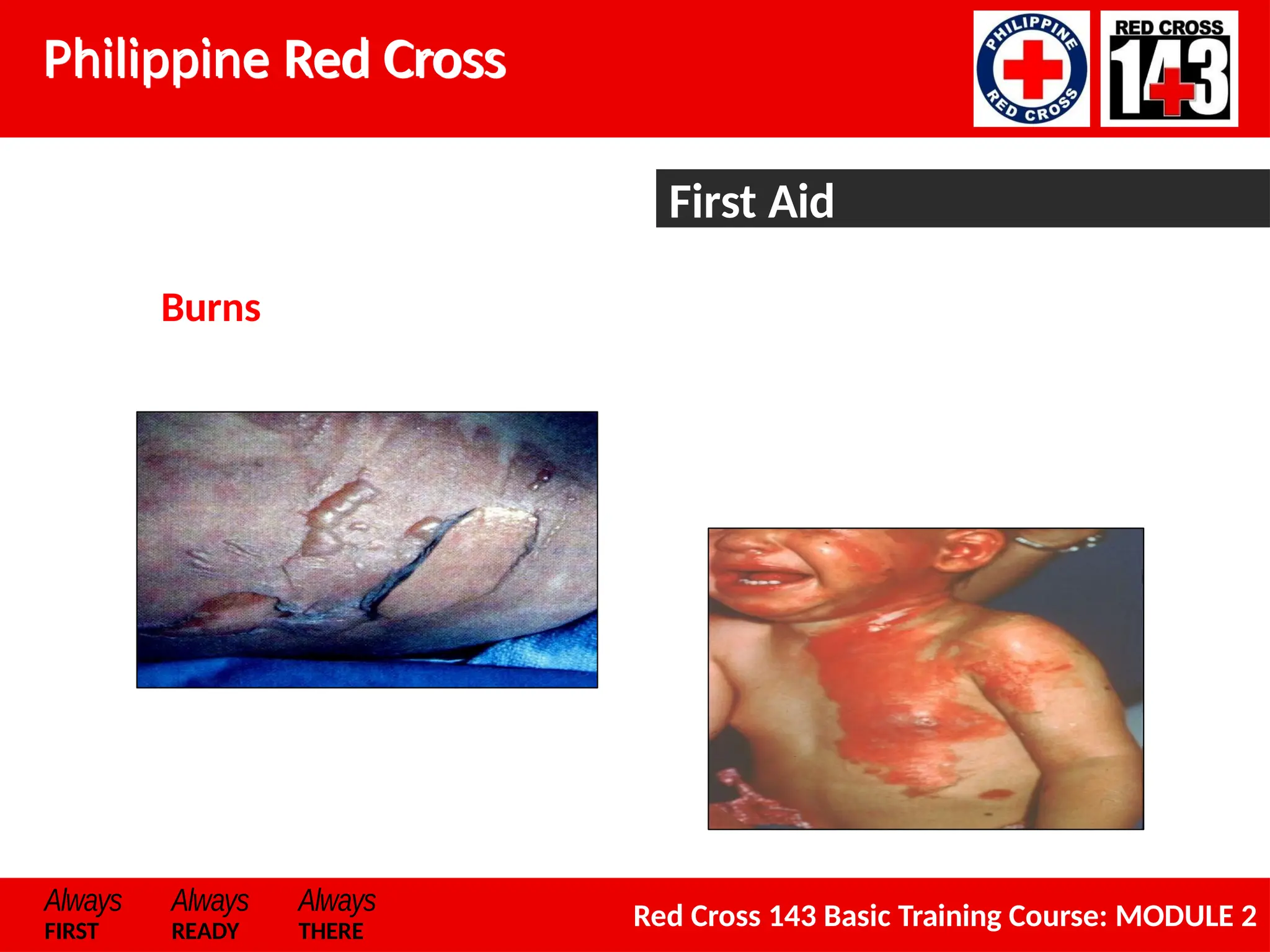 Philippine_Red_Cross_First_Aid_and_BLS_Module_2.pptx