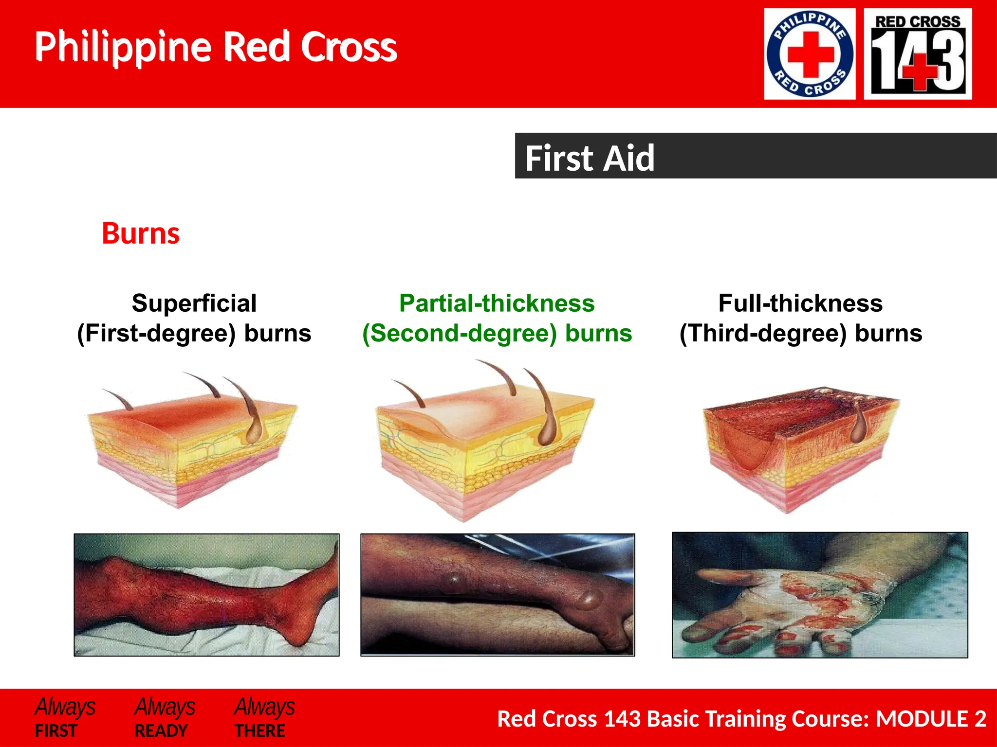 Philippine_Red_Cross_First_Aid_and_BLS_Module_2.pptx