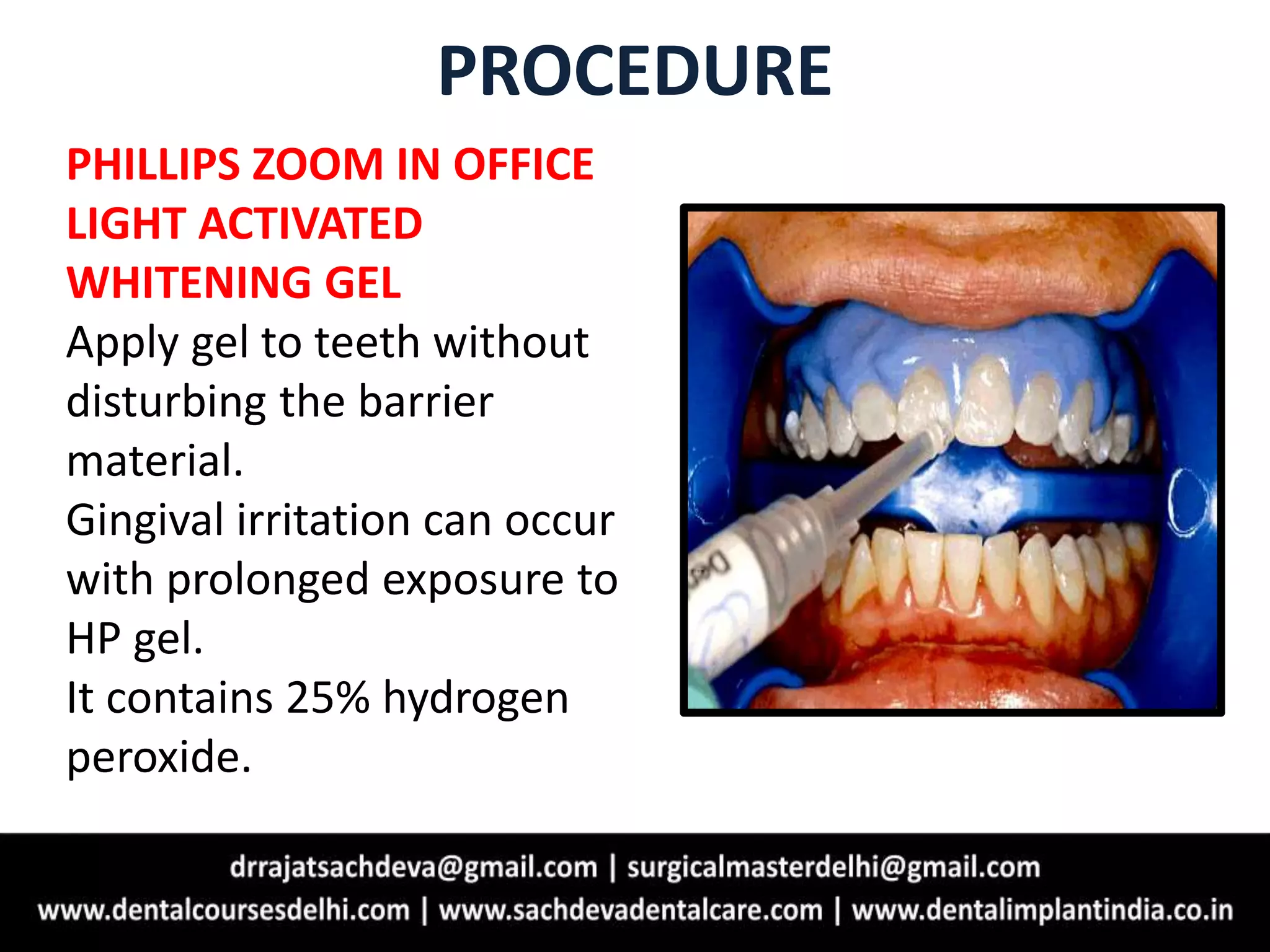 Phillips zoom whitening