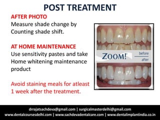 Phillips zoom whitening | PPTX