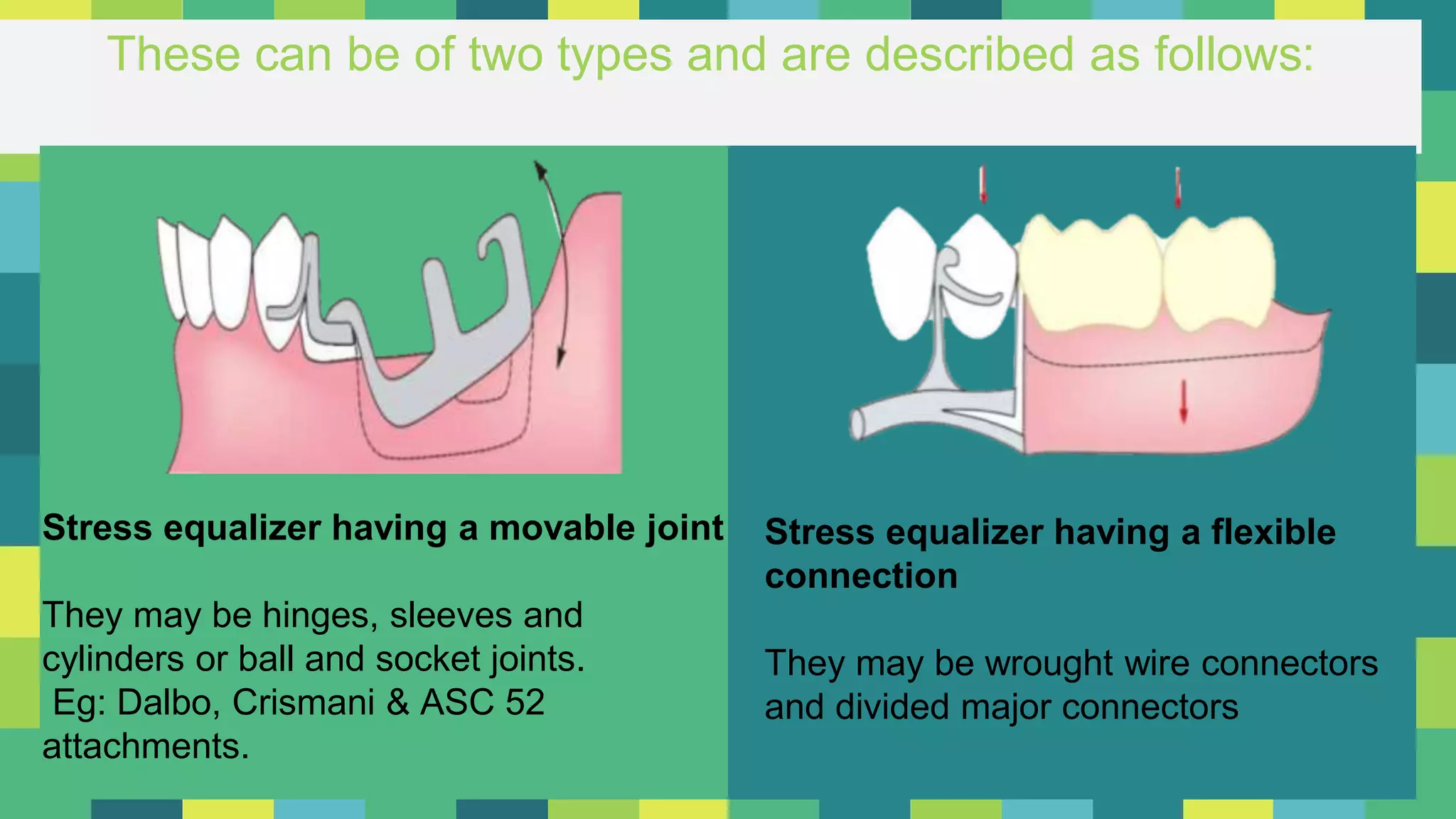 Philosophy of RPD design | PPTX