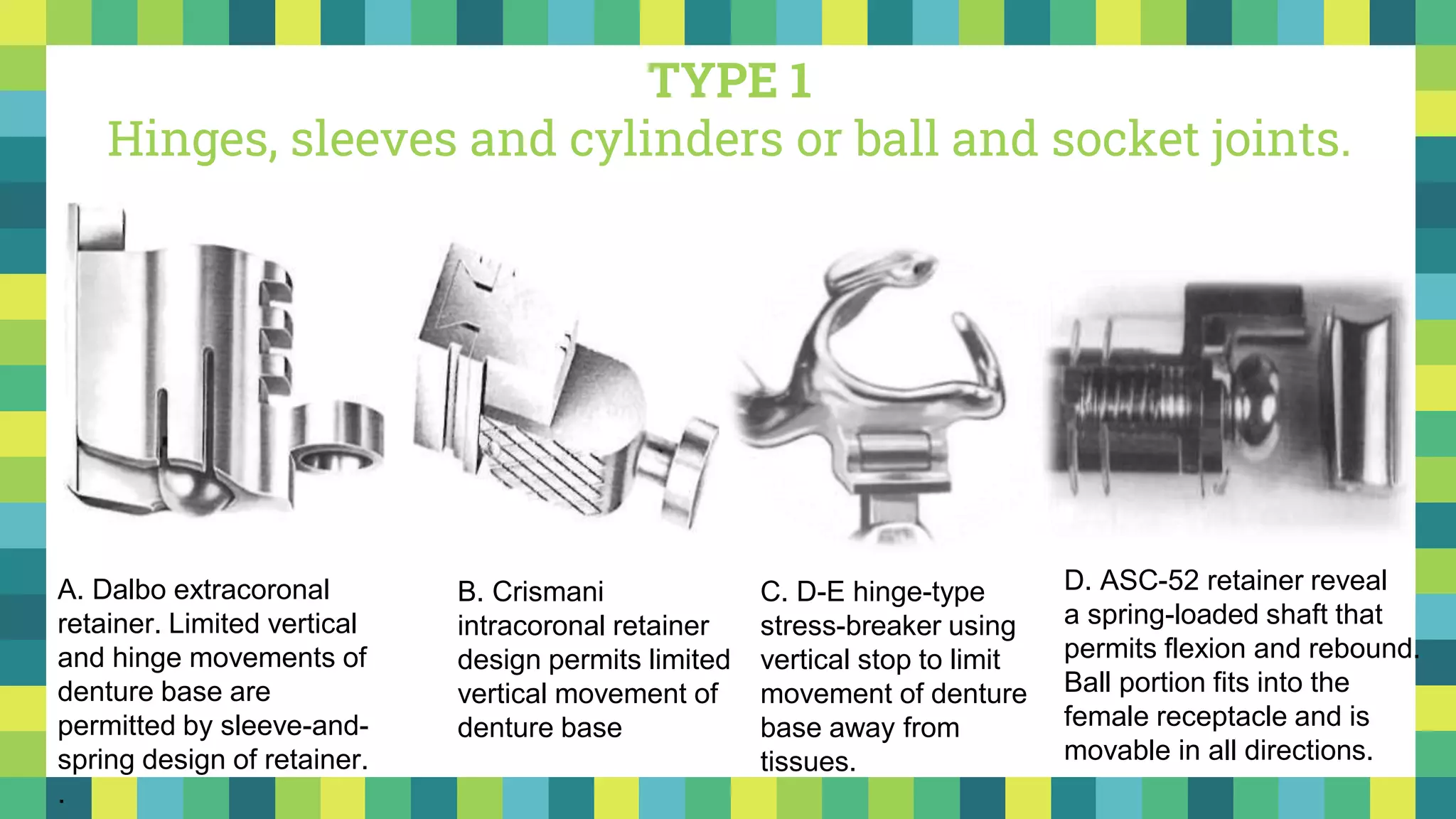 Philosophy of RPD design | PPTX