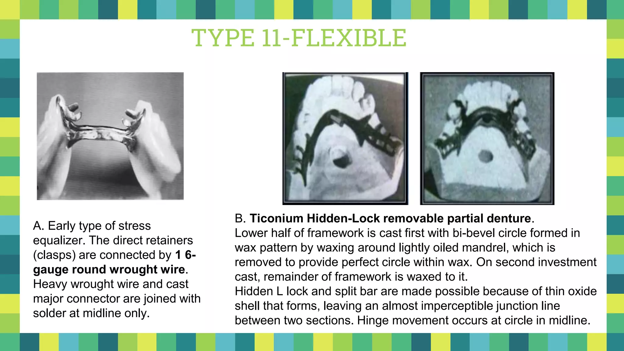 Philosophy of RPD design | PPTX