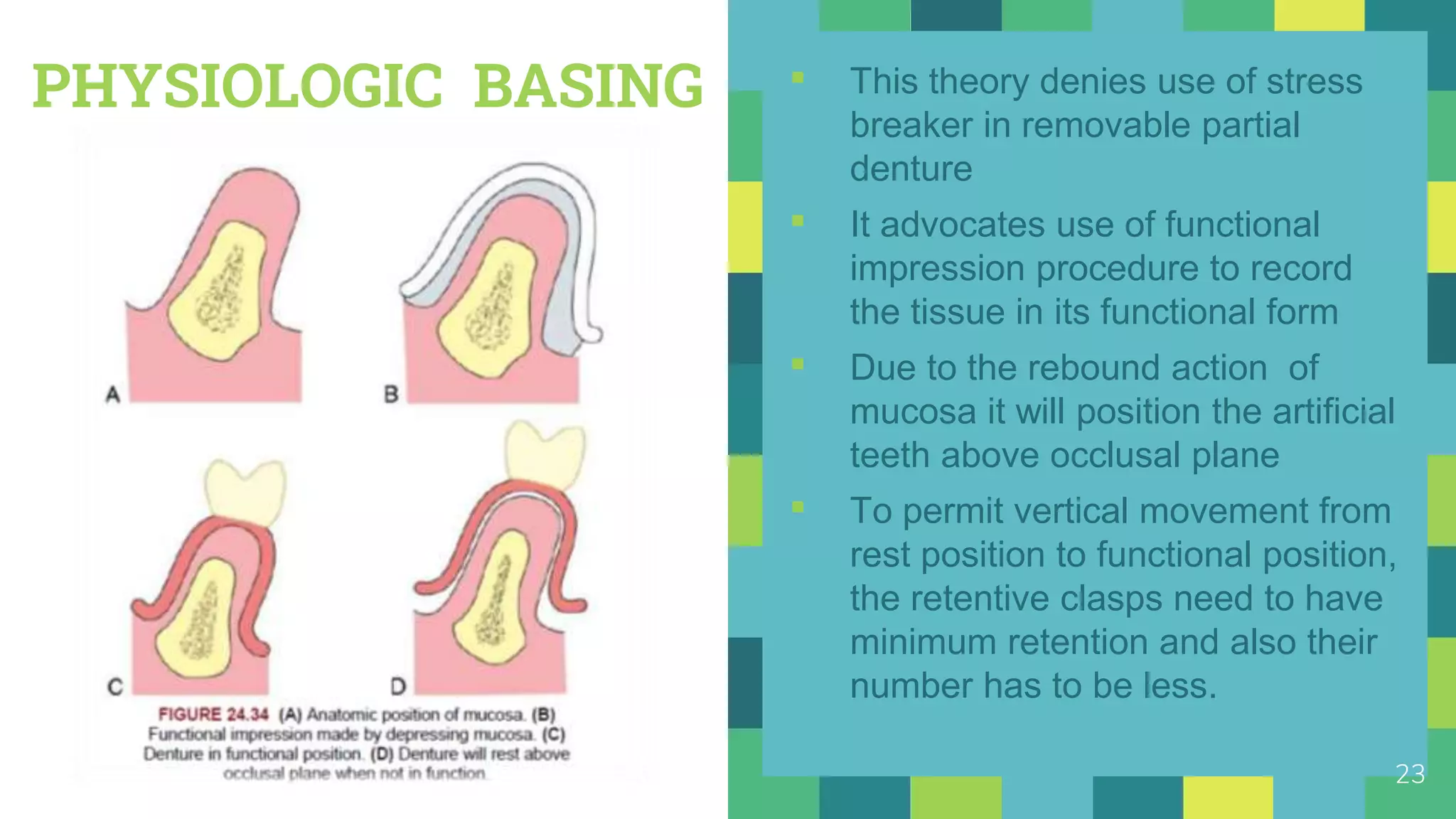 Philosophy of RPD design | PPTX