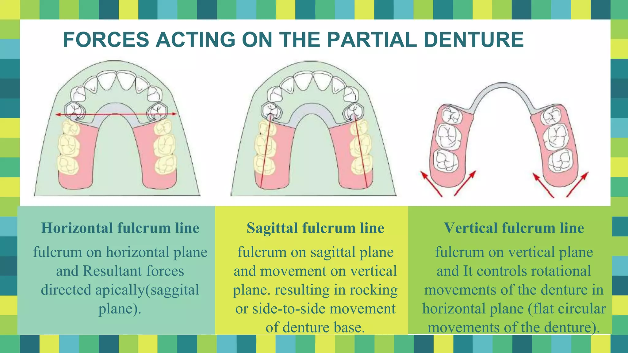 Philosophy of RPD design | PPTX