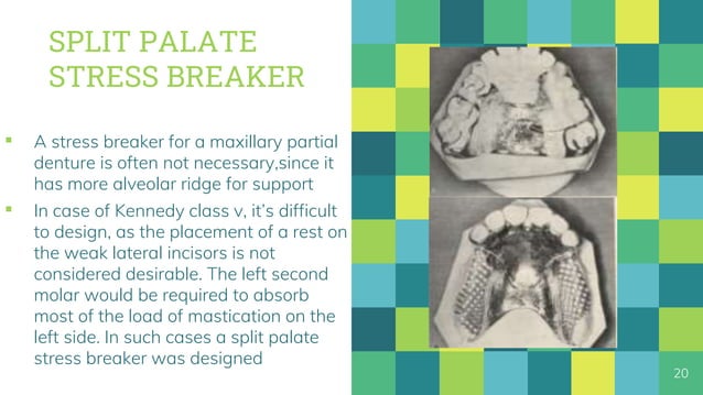 Philosophy of RPD design | PPTX | Dental Health | Diseases and Conditions