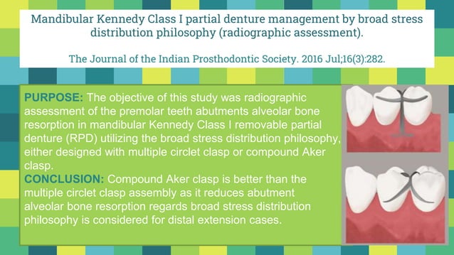 Philosophy of RPD design | PPTX | Dental Health | Diseases and Conditions