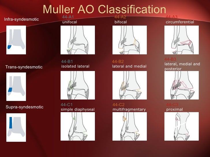 Philosophy Of Malleolar1