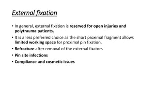 PHILOS PLATE CASE STUDY FOR SUBTROCHANTERIC FRACTURE | PPTX