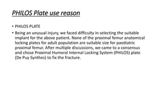 PHILOS PLATE CASE STUDY FOR SUBTROCHANTERIC FRACTURE | PPTX