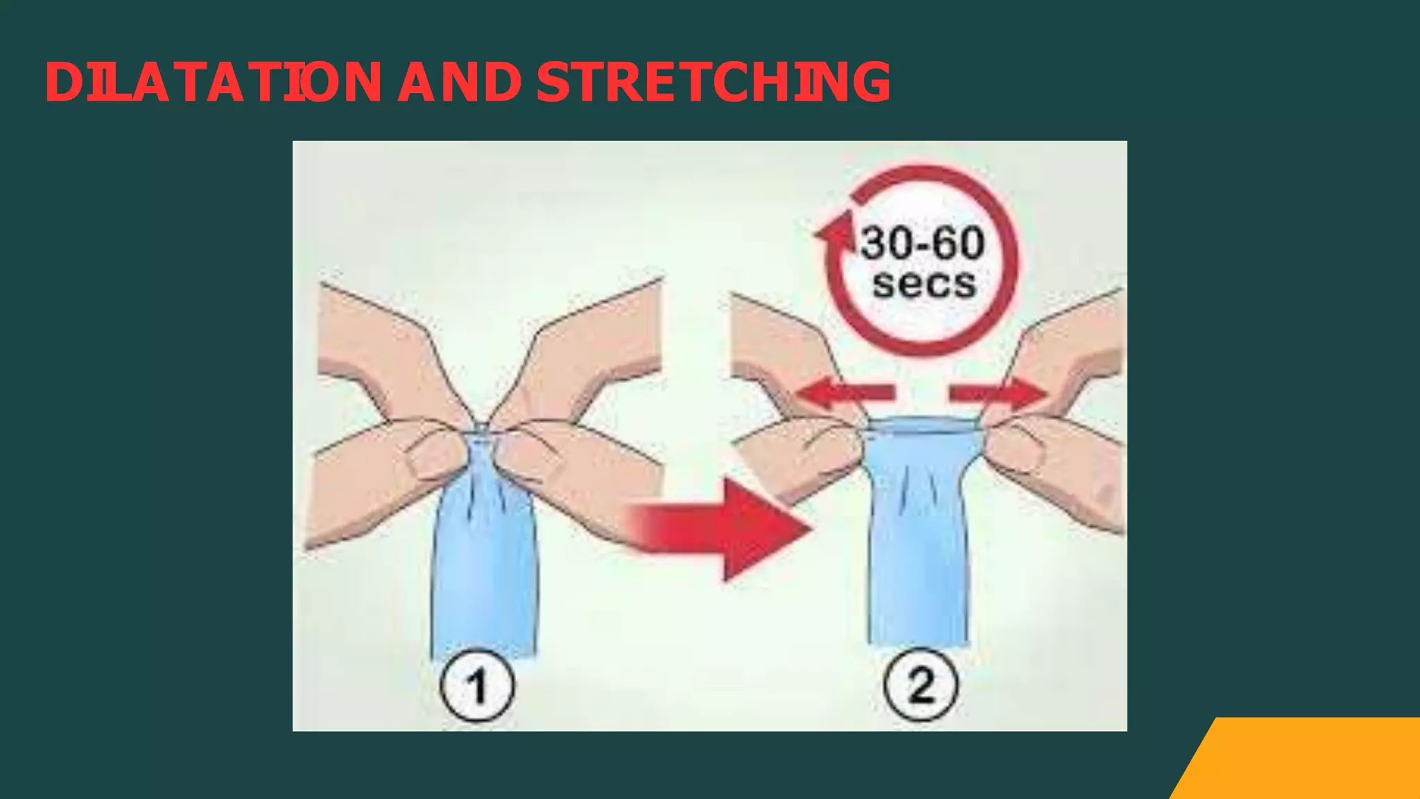 PHIMOSIS PARAPHIMOSIS | PPTX