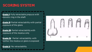 PHIMOSIS PARAPHIMOSIS | PPTX | Reproductive Health | Diseases and ...