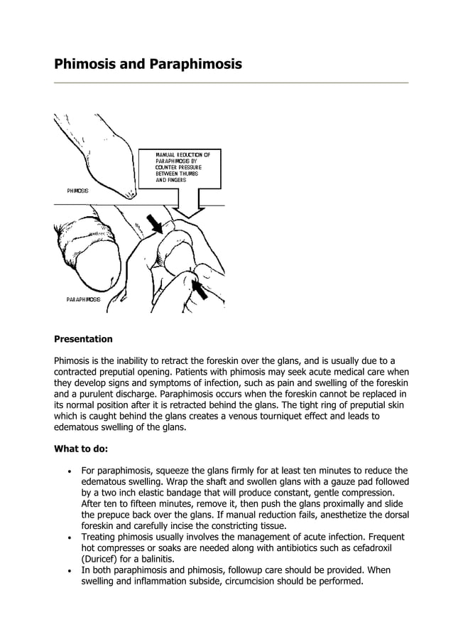 Phimosis And Paraphimosis | DOC | Sexual Conditions | Sexual Health