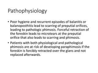 phimosis final.pptx