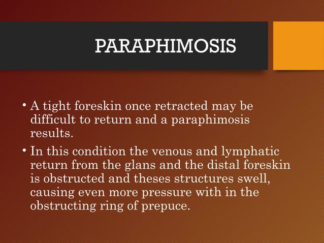 Phimosis & Paraphimosis | PPT | Surgery | Medical Health