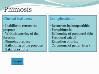 Phimosis & Paraphimosis - An Ayurvedic and Modern aspect.pptx