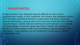 phimosis, paraphimosis & carcinoma of the penis (CBME).pptx