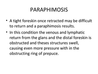 Phimosis, paraphimosis & circumcision | PPT