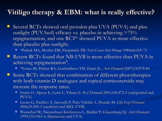 Phisical treatments in Vitiligo - Prof. Lotti Torello, MD | PPT