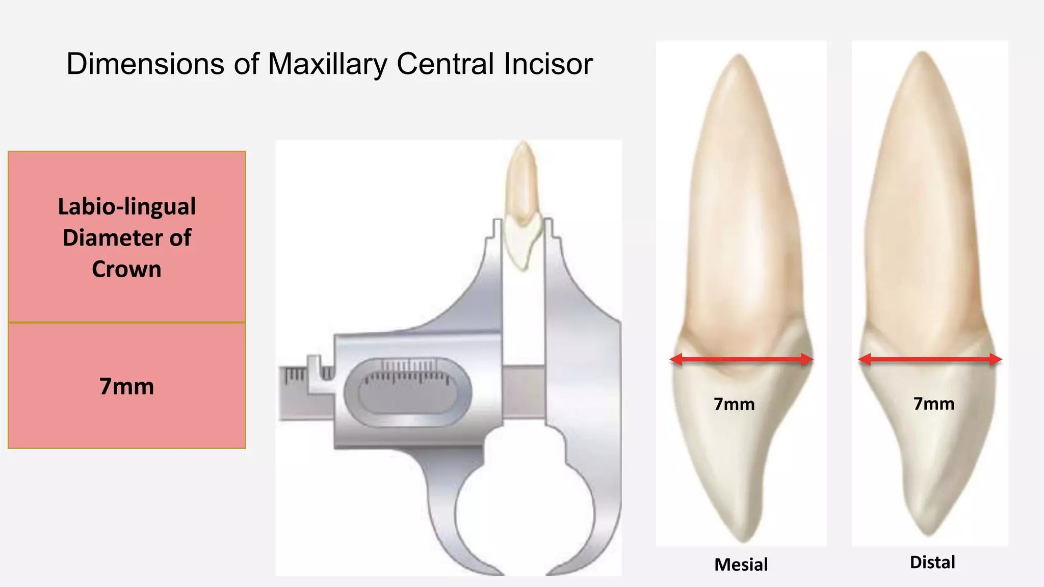 Morphology of Permanent Maxillary Central Incisor- Dr. Saba Arshad.pptx