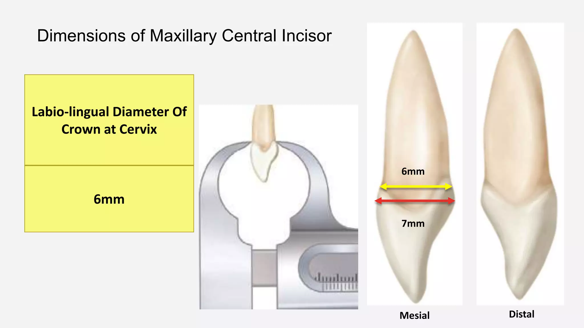 Morphology of Permanent Maxillary Central Incisor- Dr. Saba Arshad.pptx