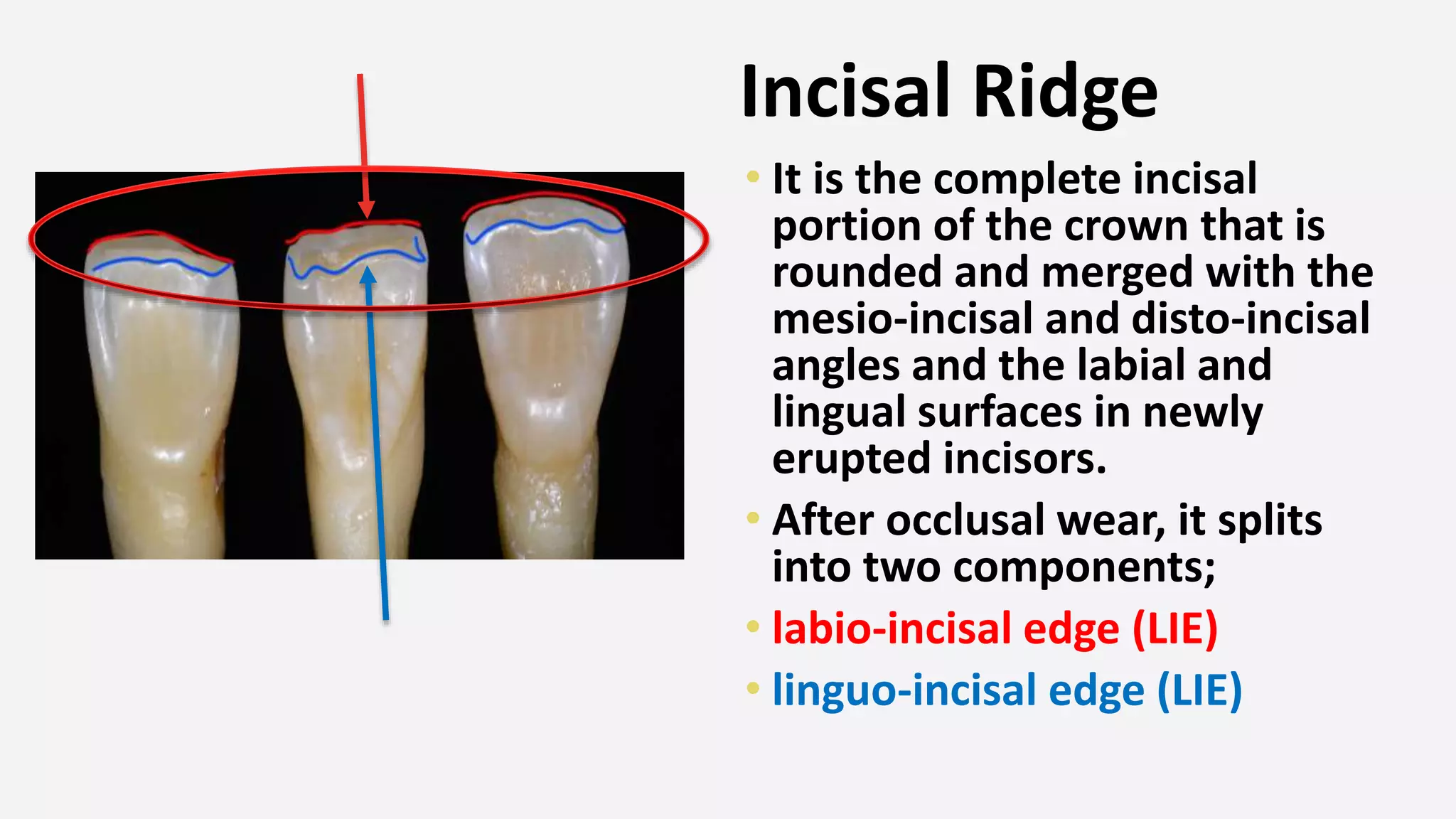 Morphology of Permanent Maxillary Central Incisor- Dr. Saba Arshad.pptx