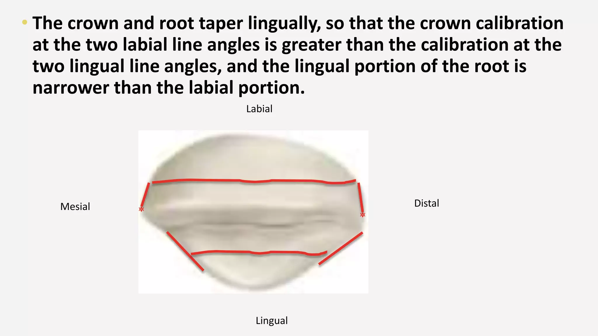 Morphology of Permanent Maxillary Central Incisor- Dr. Saba Arshad.pptx