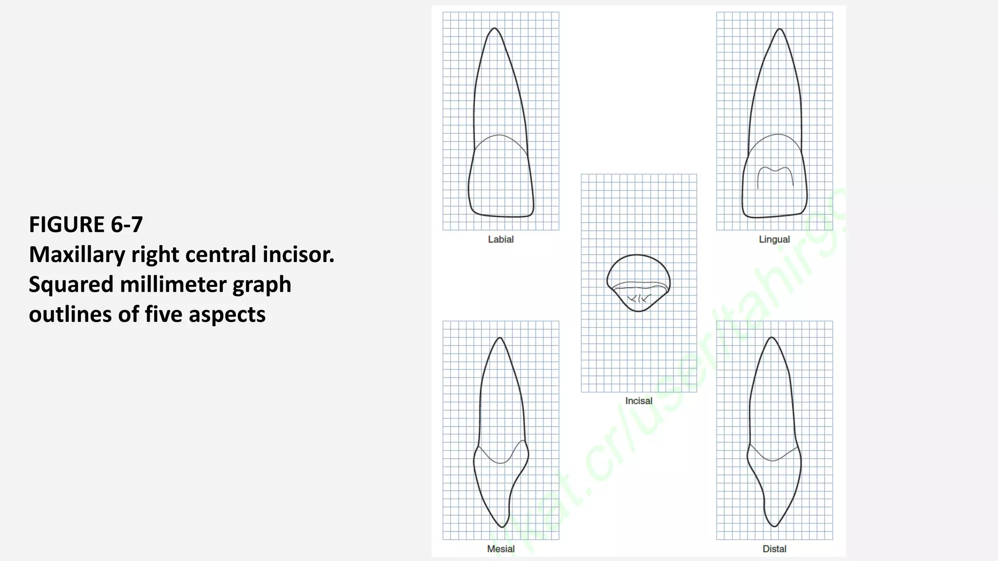 Morphology of Permanent Maxillary Central Incisor- Dr. Saba Arshad.pptx