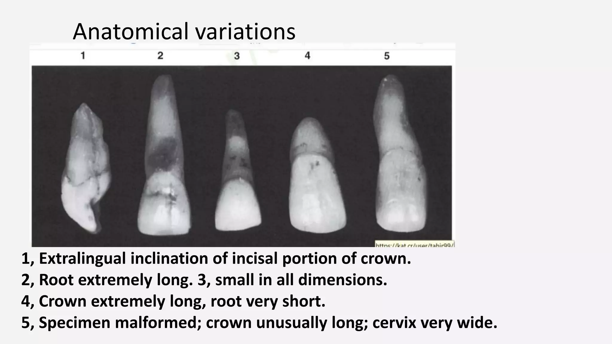 Morphology of Permanent Maxillary Central Incisor- Dr. Saba Arshad.pptx