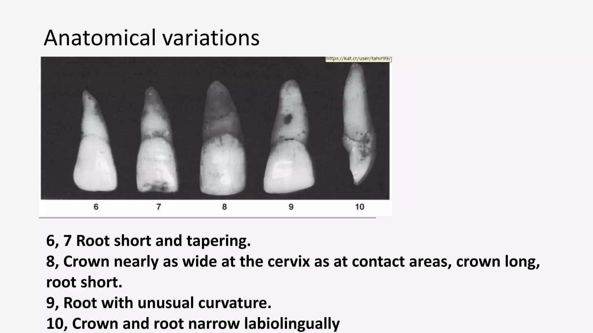 Morphology of Permanent Maxillary Central Incisor- Dr. Saba Arshad.pptx