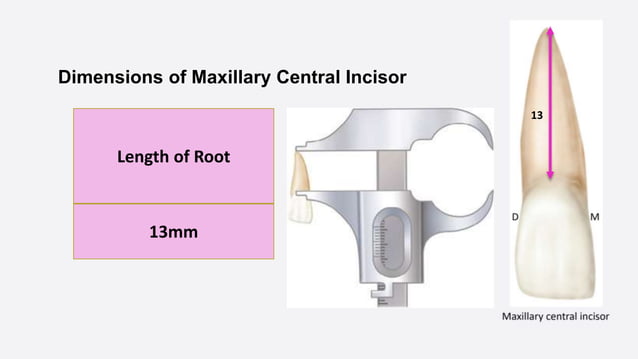 Morphology of Permanent Maxillary Central Incisor- Dr. Saba Arshad.pptx ...