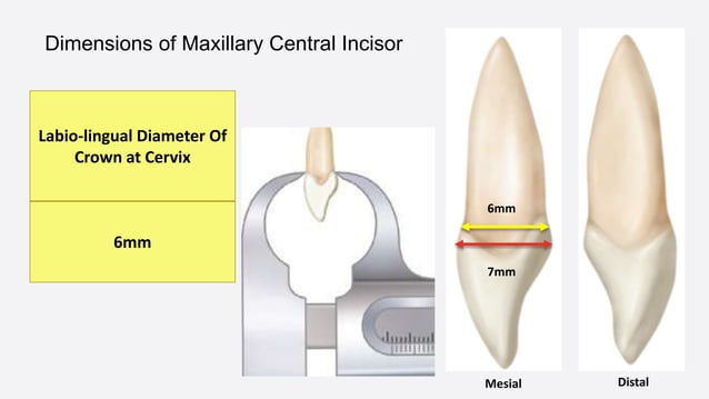 Morphology of Permanent Maxillary Central Incisor- Dr. Saba Arshad.pptx ...