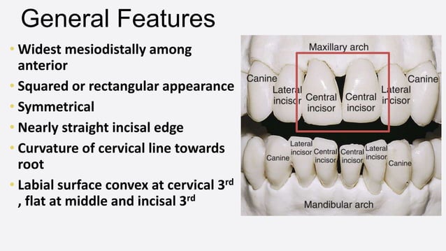 Morphology of Permanent Maxillary Central Incisor- Dr. Saba Arshad.pptx | Dental Health ...