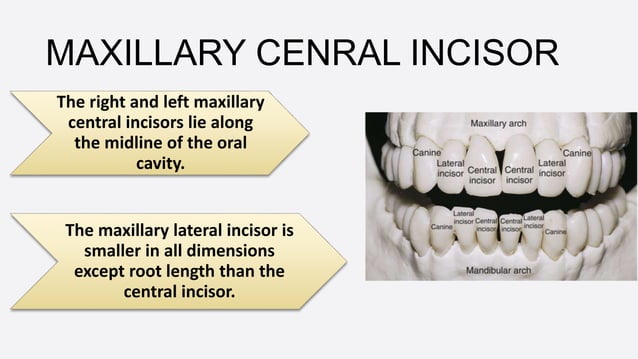Morphology of Permanent Maxillary Central Incisor- Dr. Saba Arshad.pptx | Dental Health ...