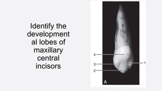 Morphology of Permanent Maxillary Central Incisor- Dr. Saba Arshad.pptx