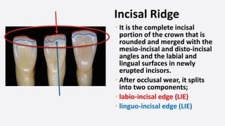 Morphology of Permanent Maxillary Central Incisor- Dr. Saba Arshad.pptx