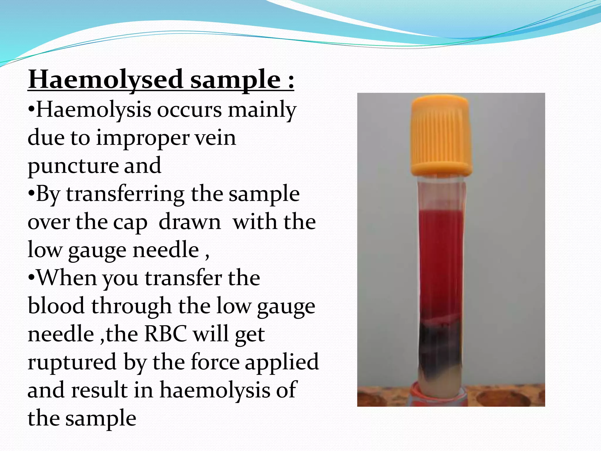 Phlebotomy and Pre-analytical error ppt.pptx