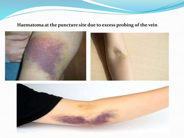 Phlebotomy and Pre-analytical error ppt.pptx