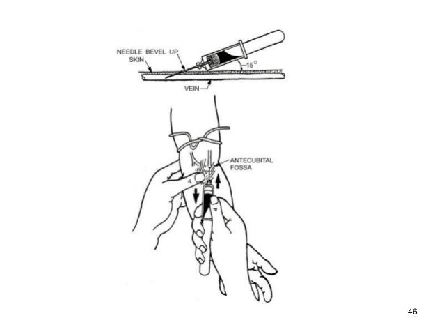 Phlebotomy for Medical Laboratory Professionals