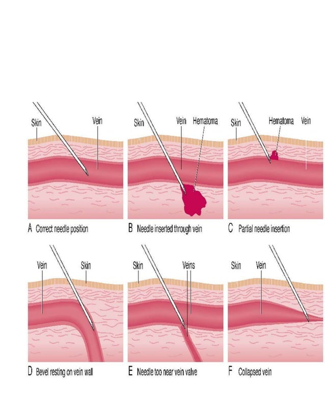 Phlebotomy Made Easy | DOCX