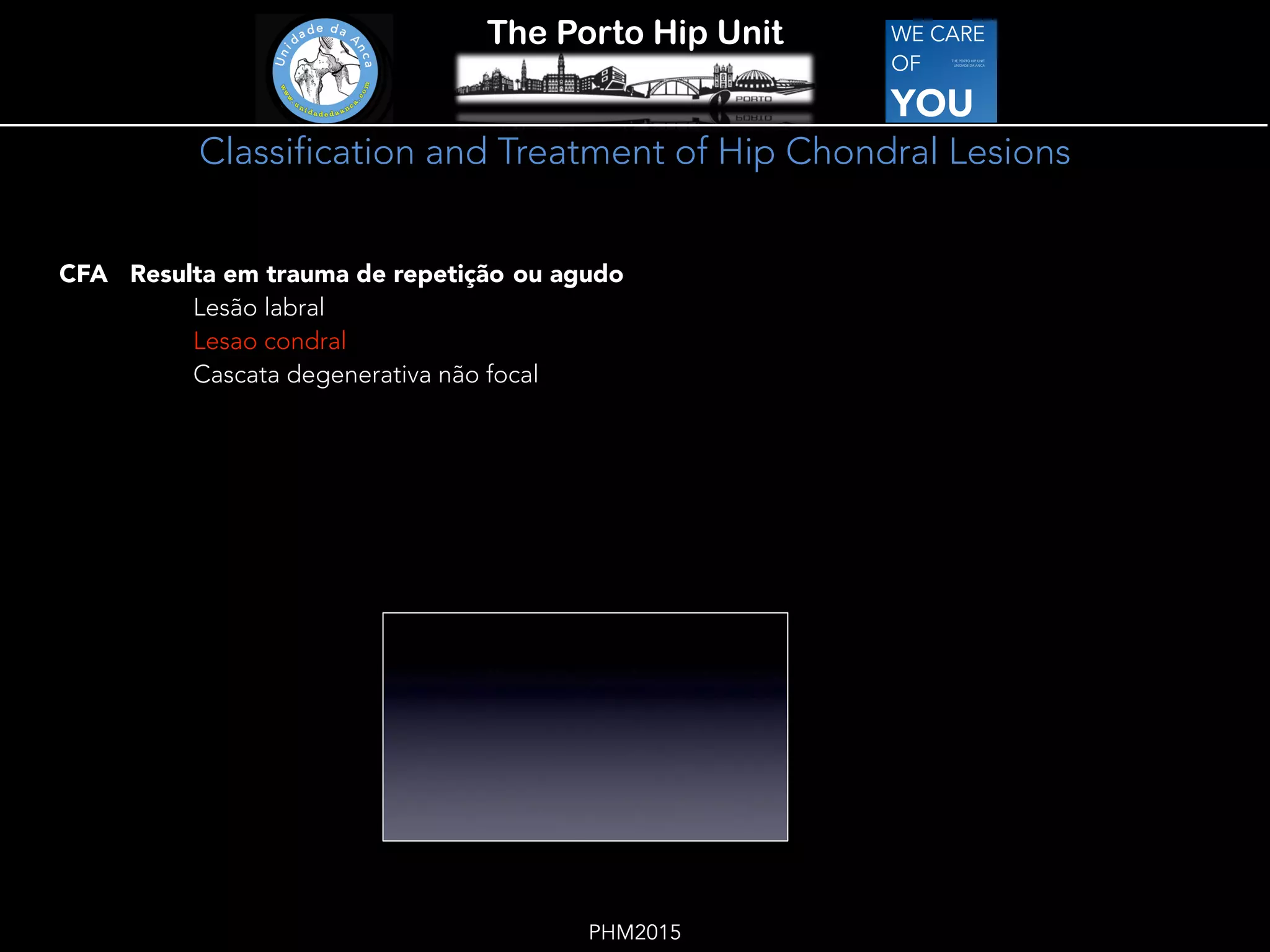 Classification and Treatment of Hip Chondral Lesions | PDF