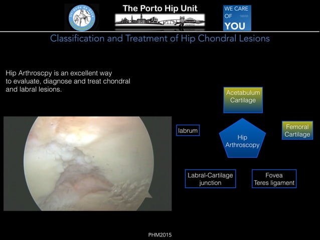 Classification and Treatment of Hip Chondral Lesions | PPT