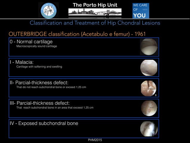Classification and Treatment of Hip Chondral Lesions | PPT