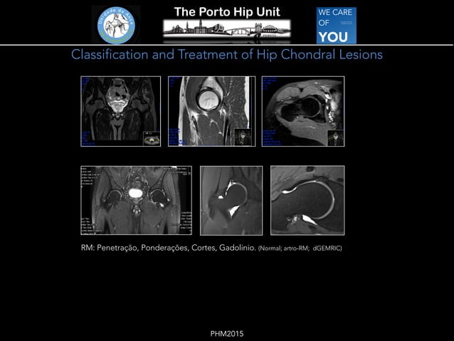 Classification and Treatment of Hip Chondral Lesions | PPT