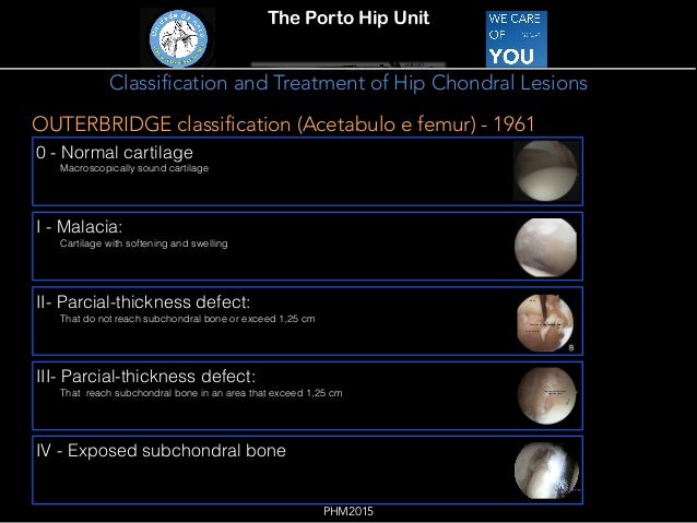 Classification and Treatment of Hip Chondral Lesions