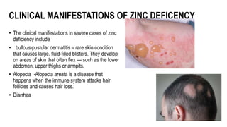 PHN - zinc deficiency.pptx