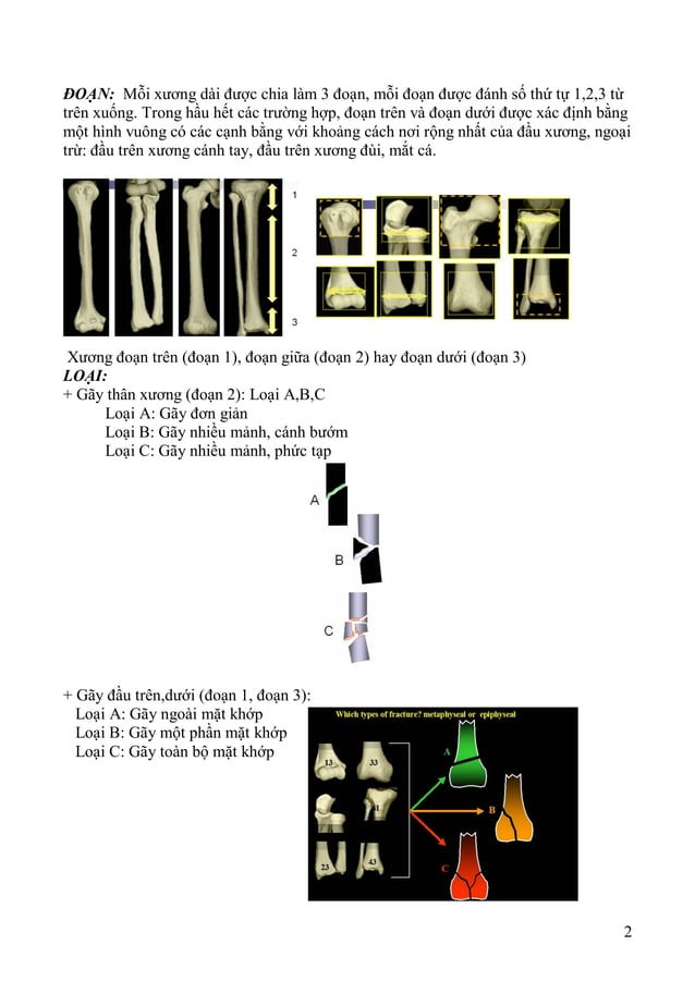 Phân loại gãy xương theo ao | PDF