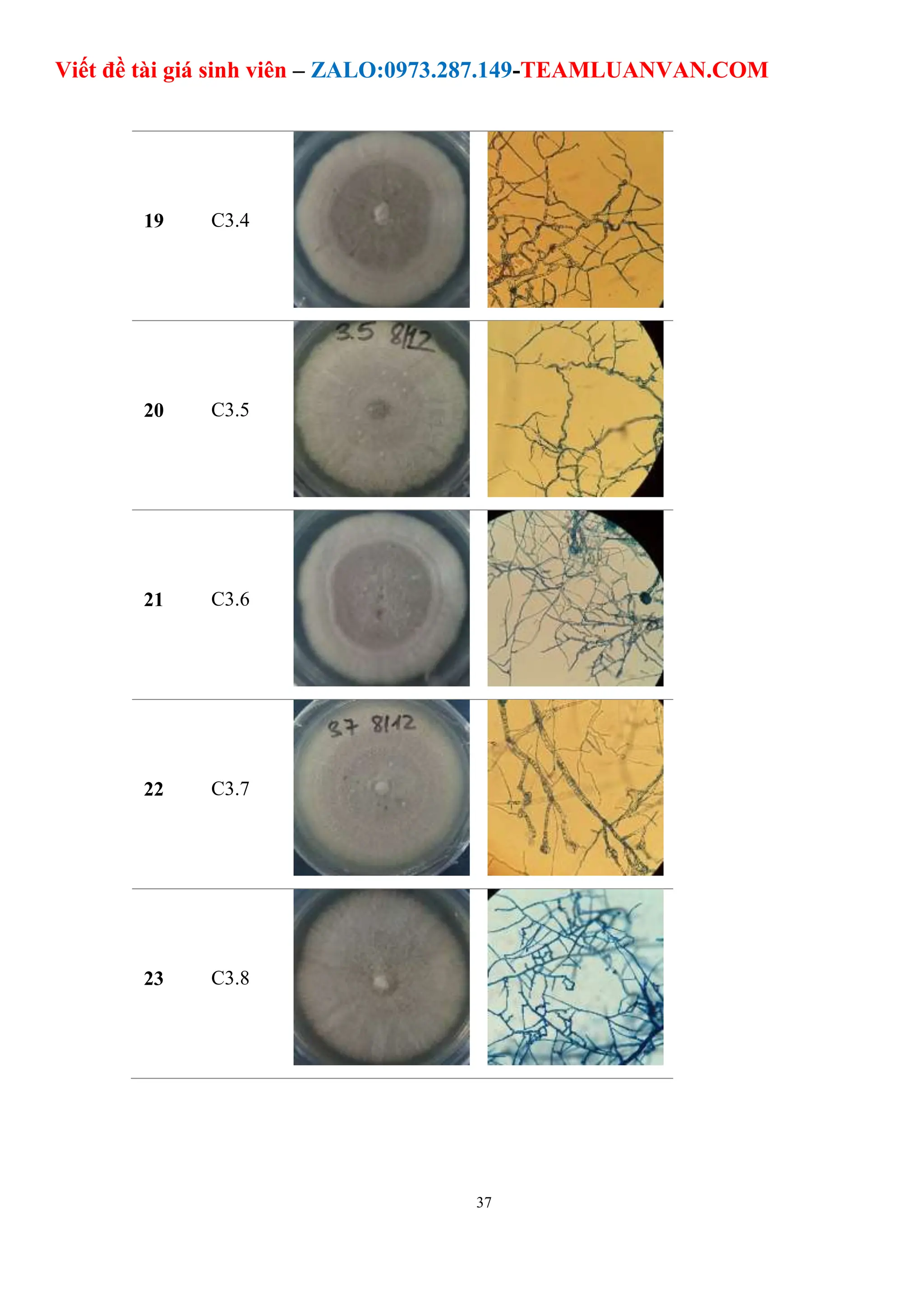 Phân lập và tuyển chọn các chủng bacillus spp.Có khả năng đối kháng sinh học với nấm ...