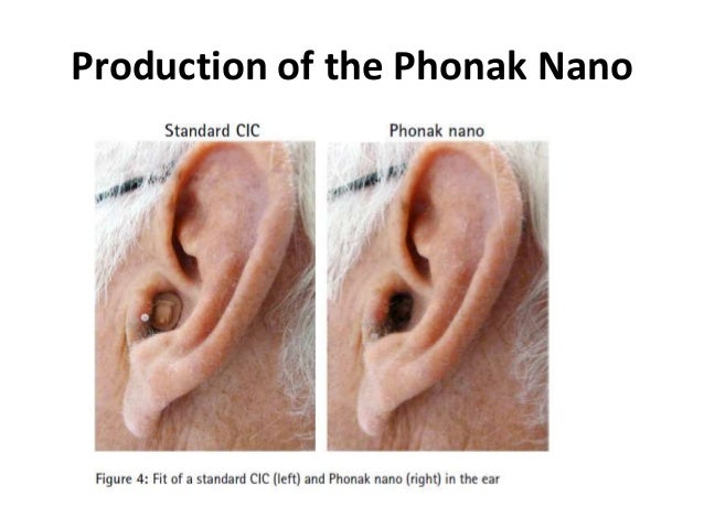 Phonak nano is an excellent new custom hearing system from bengal spe…