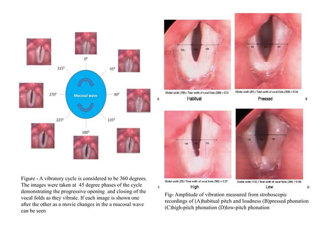 PHONATION.pptx | Ear, Nose and Throat Conditions | Diseases and Conditions